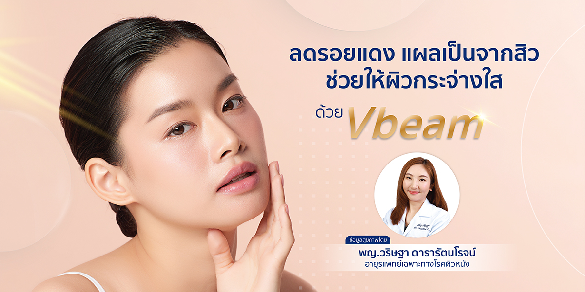 ลดรอยแดง แผลเป็นจากสิว ช่วยให้ผิวกระจ่างใสด้วย วีบีม (Vbeam ...