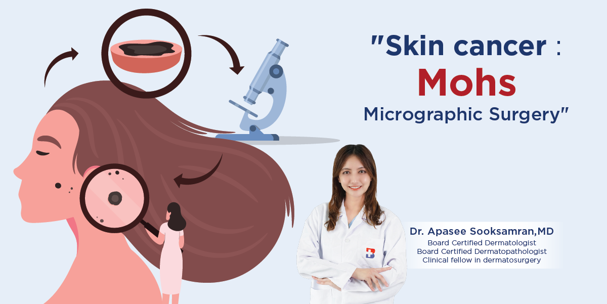 “Skin cancer : Mohs Micrographic Surgery” | Bangkok Hospital Phuket – International Hospitals in ...