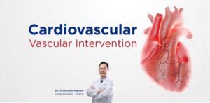 Cardiovascular Vascular Intervention | Bangkok Hospital Phuket ...