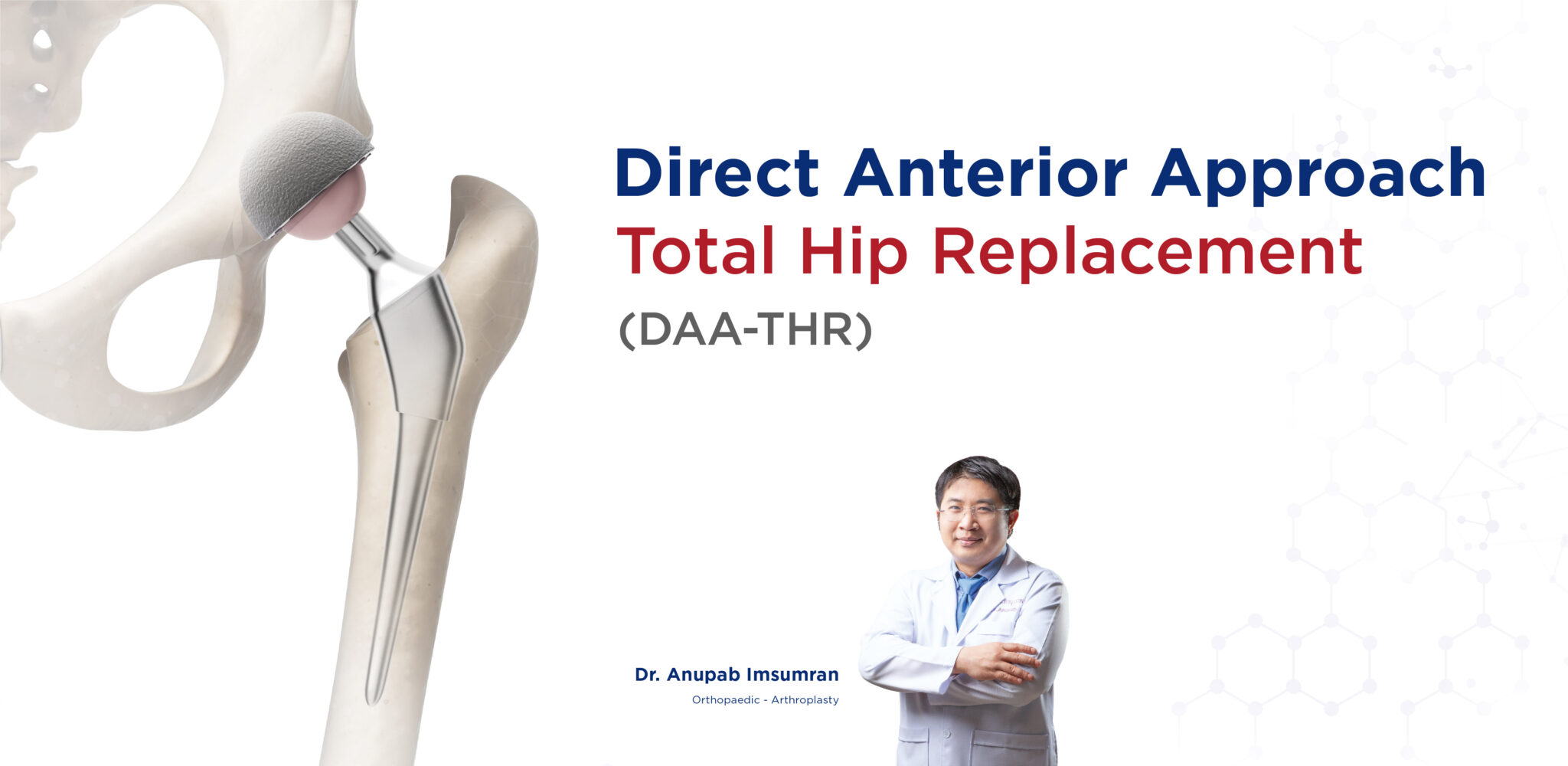Direct Anterior Approach Total Hip Replacement (DAA-THR) | Bangkok Hospital Phuket ...