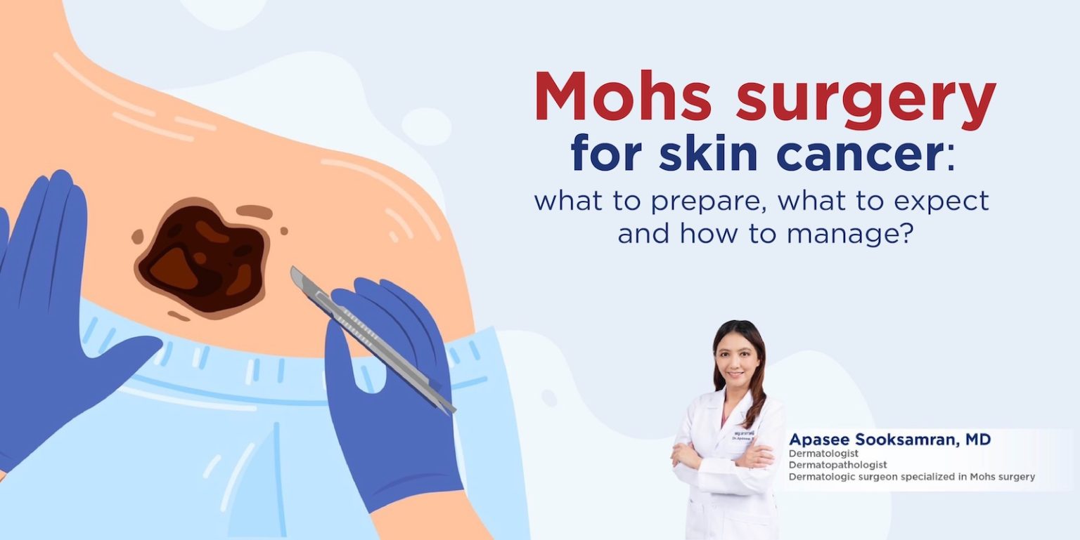 Mohs surgery for skin cancer: what to prepare, what to expect and how ...